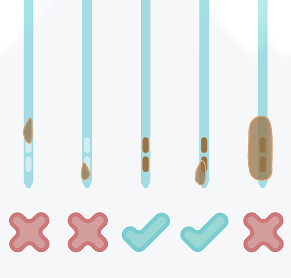 Taking a FIT Test - Faecal Immunochemical Test