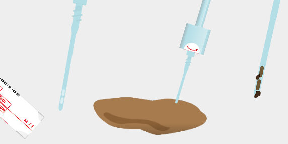Getting a FIT Sample - Faecal Immunochemical Test